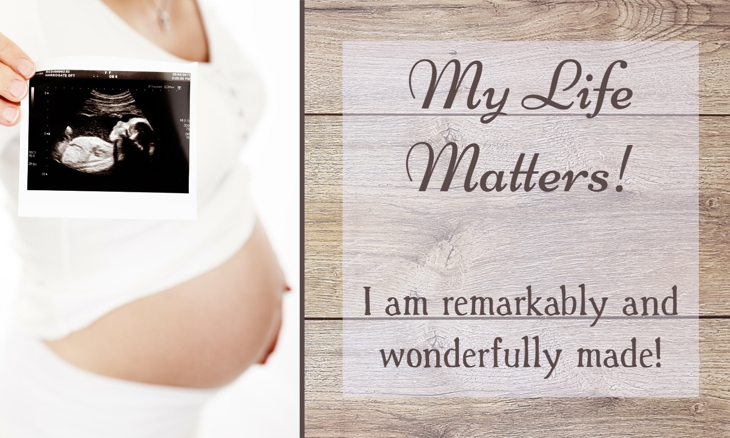 Your Life Matters! - She Lives Worthy